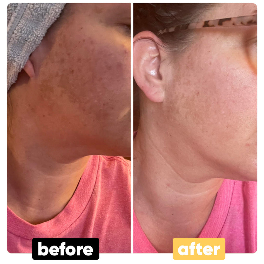 lemon turmeric & kojic acid brightening soap – Scentric Glow