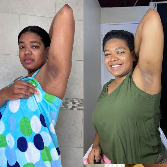 5 Reasons Why Skeptics Are Converting to This 'TikTok-Famous' Brighten ...