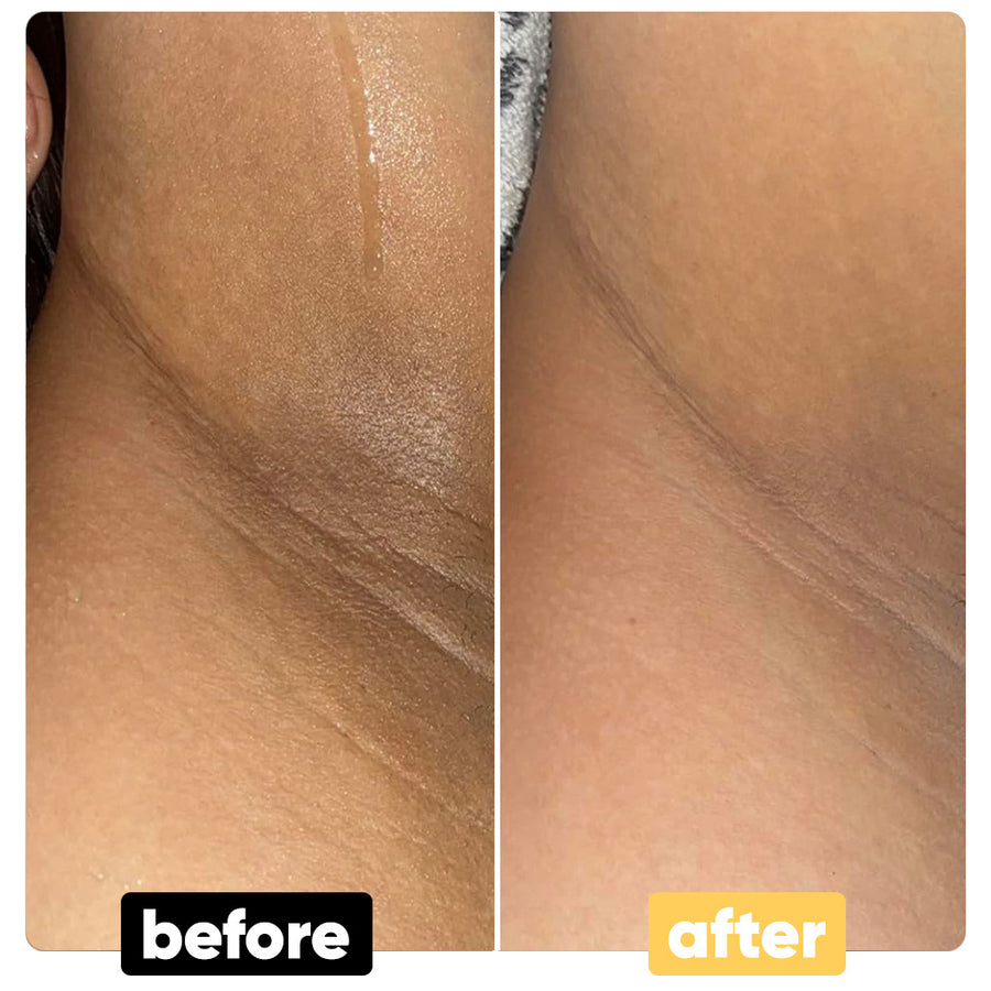 lemon turmeric & kojic acid brightening soap – Scentric Glow